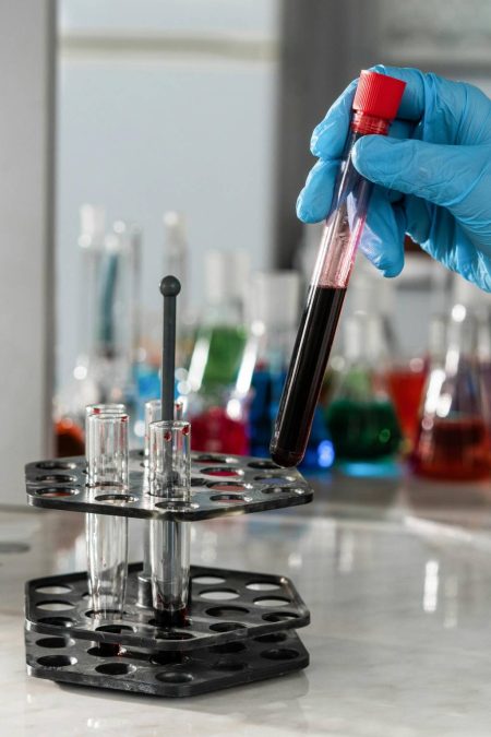 Comprendre les différents types de cancer du sang - Santé Today